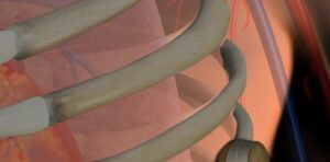 Comprehensive Icd 9 Code For Skin Conditions Guide
